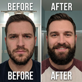 Aparthy Beard Growth Roll on Serum