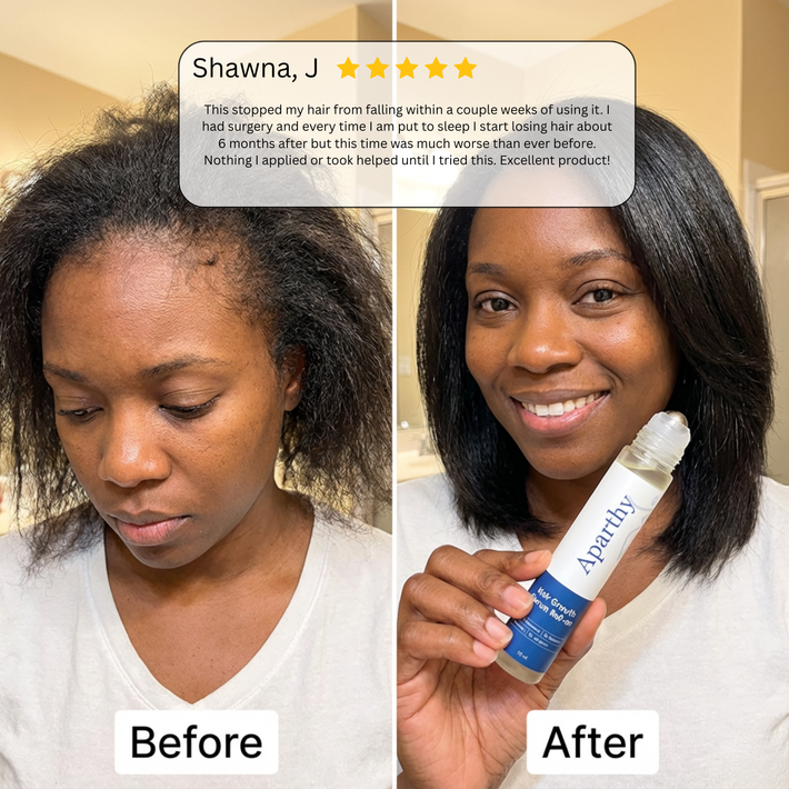 Aparthy Hair Growth Roll on Serum