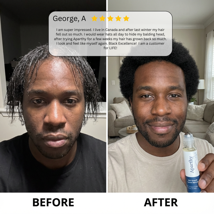Aparthy Hair Growth Roll on Serum