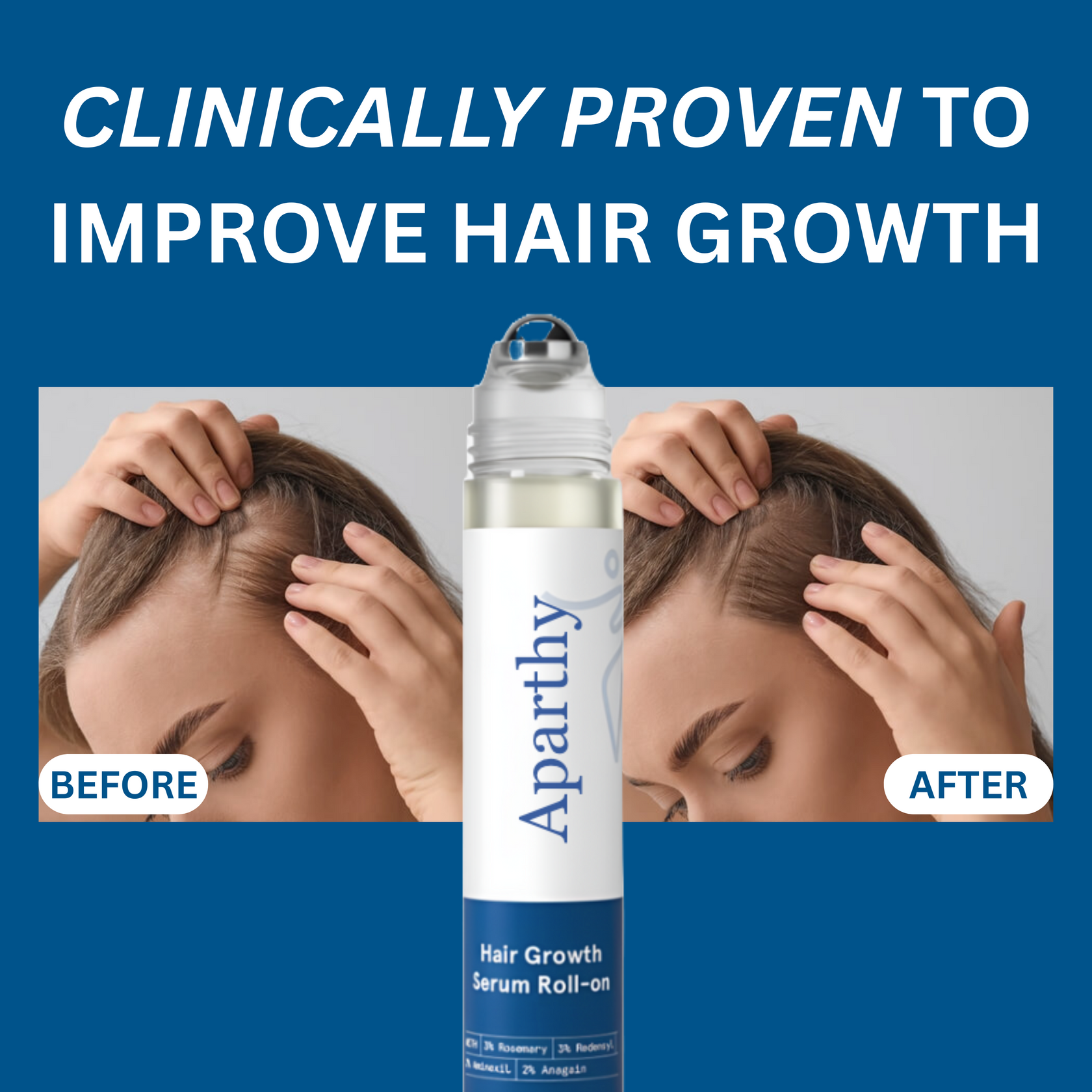 Advanced Hair Growth Roll-On Serum – Aparthy